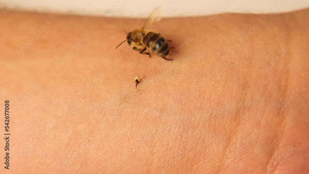 Honey bee stings a man's arm. When the sting is over, the honeybee ...