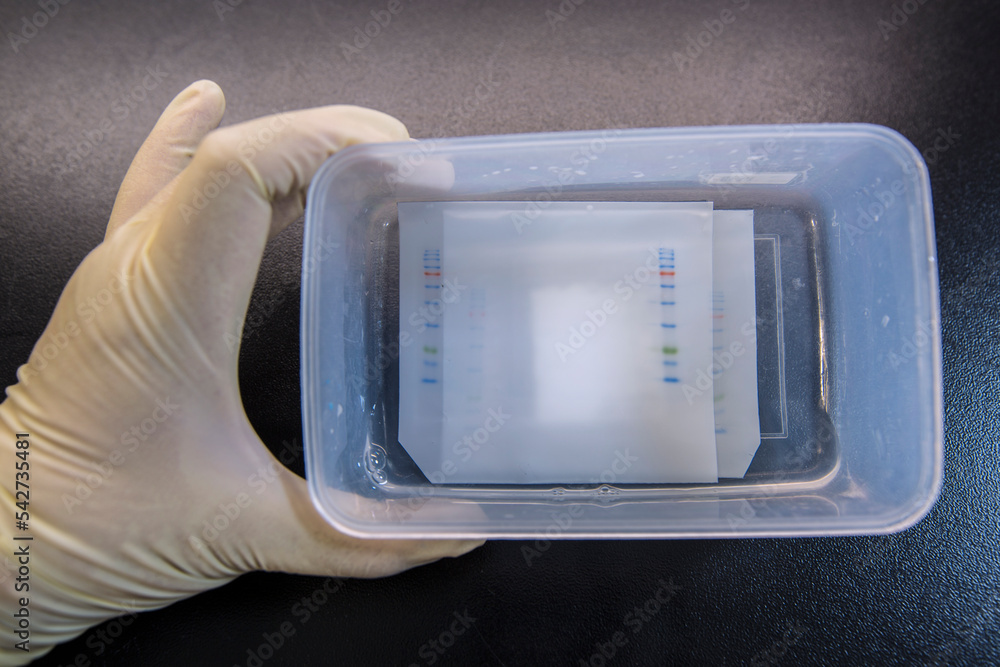 Western blot analysis or protein analysis Stock Illustration | Adobe Stock