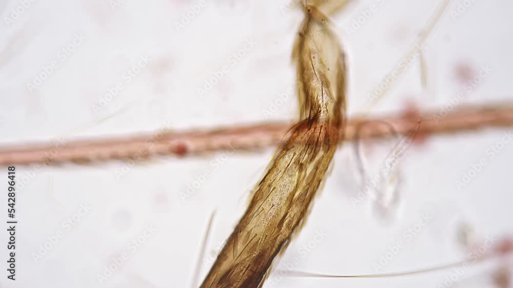 Mouthpart of mosquito whole mount in scientific slide shown under ...