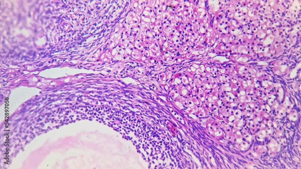 Ovary in section magnified under microscope 200x against bright field ...