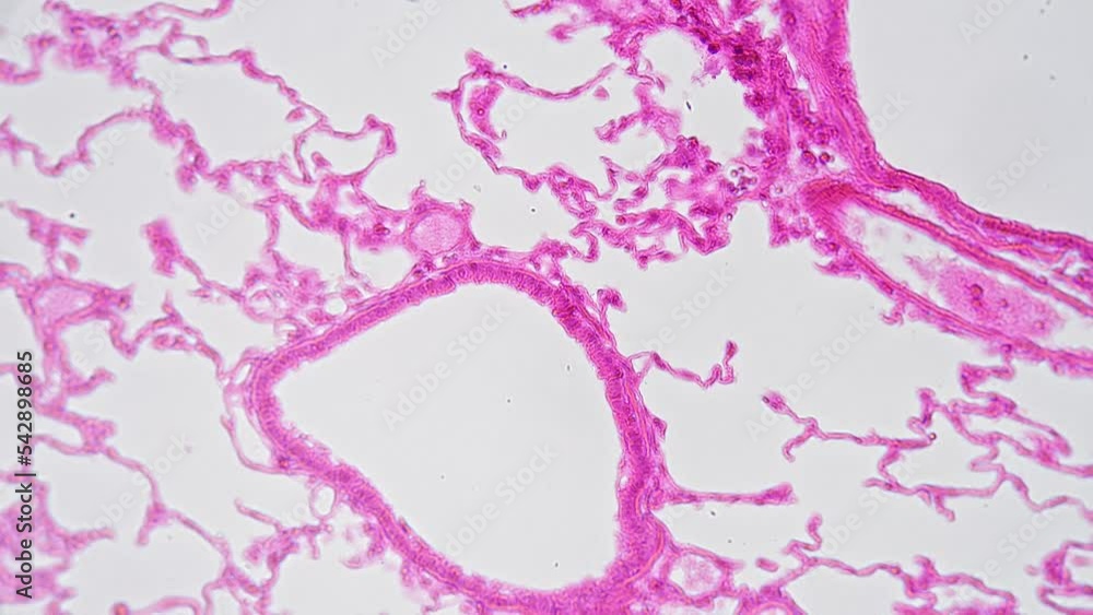 Tissues of lung in section filmed under microscope magnified in 400 ...