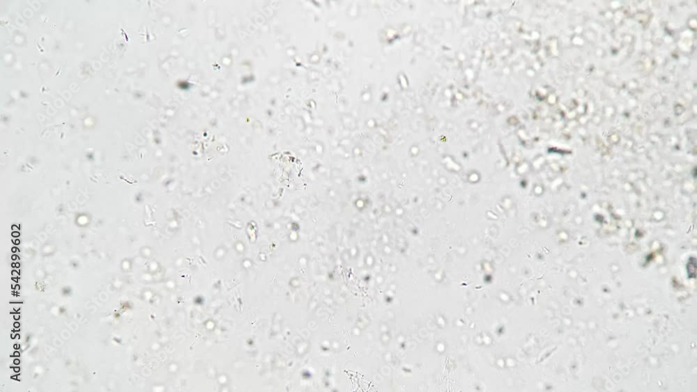 Zygote of ascarid lumbricoide whole mount filmed under microscope 200x ...