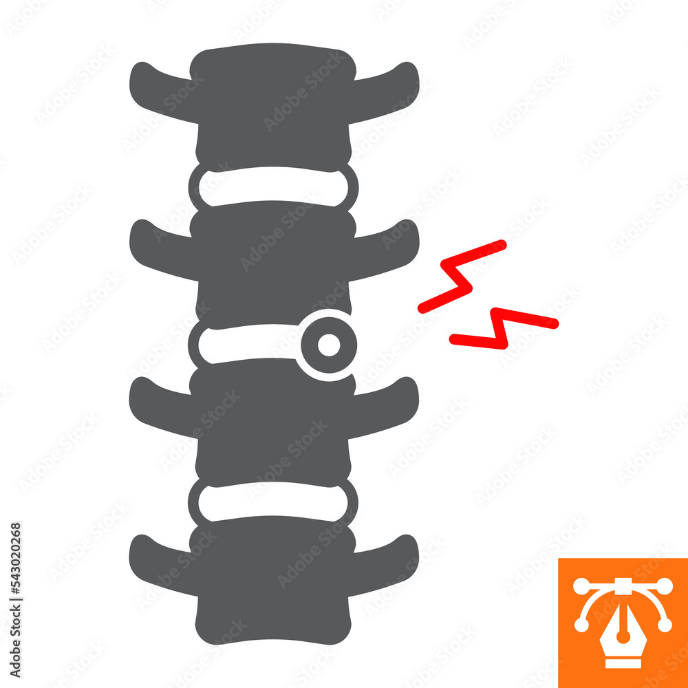 Intervertebral hernia solid icon, glyph style icon for web site or ...