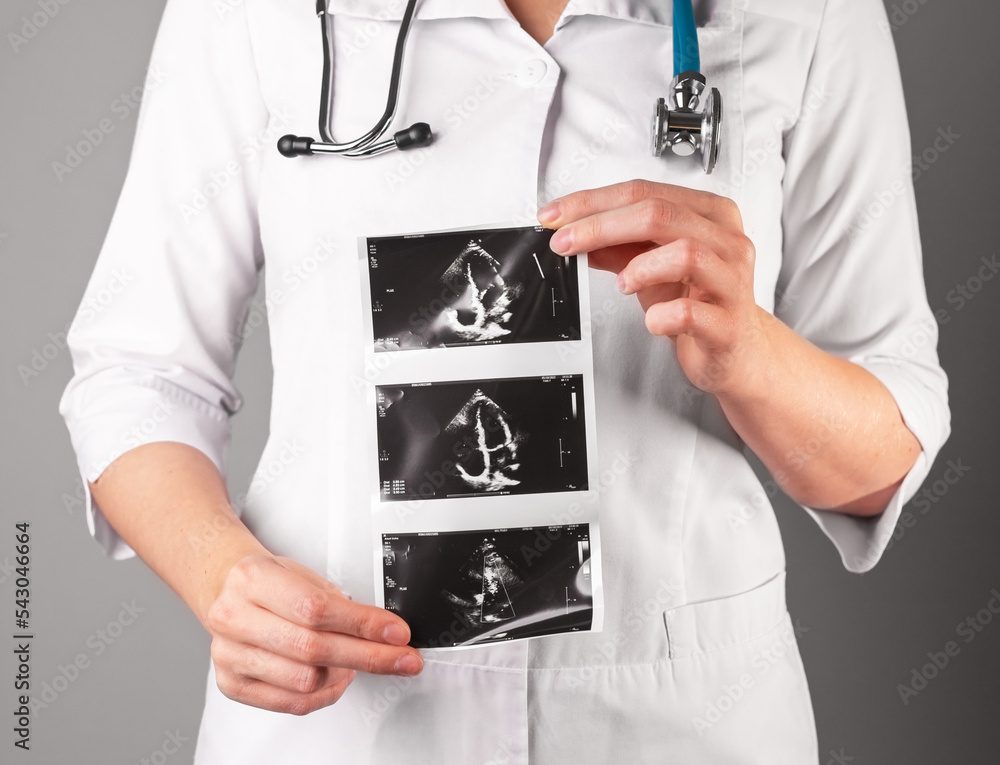Heart ultrasound, cardiac scan, checkup result Stock Photo | Adobe Stock