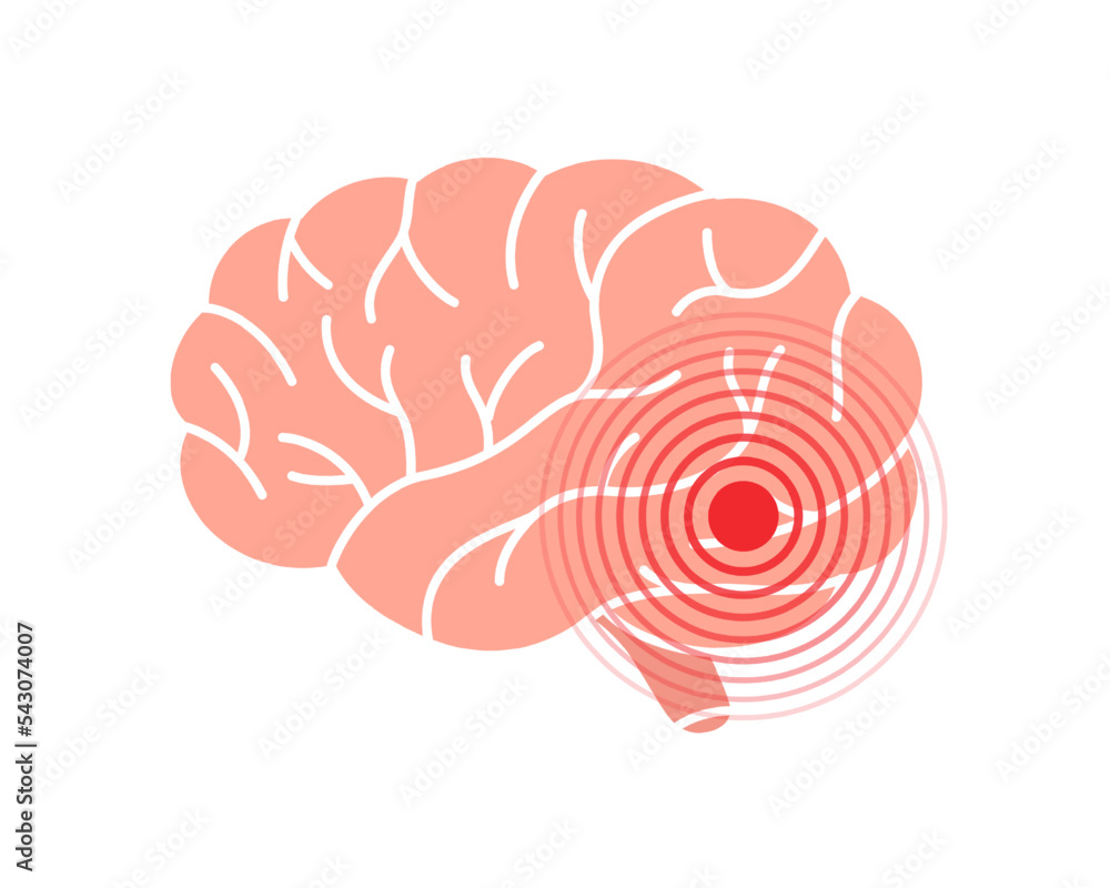 Human brain pain symbol. Brain ache icon. Vector illustration. Human ...