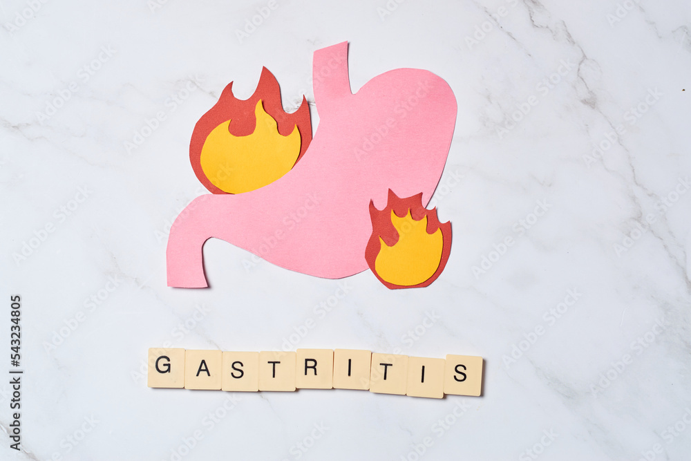 Stomach on fire. Concept of gastritis and stomach ulcers. Stock Photo ...