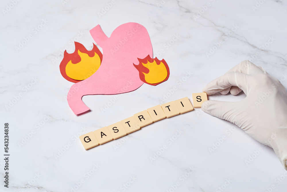 Stomach on fire. Concept of gastritis and stomach ulcers. Stock Photo ...