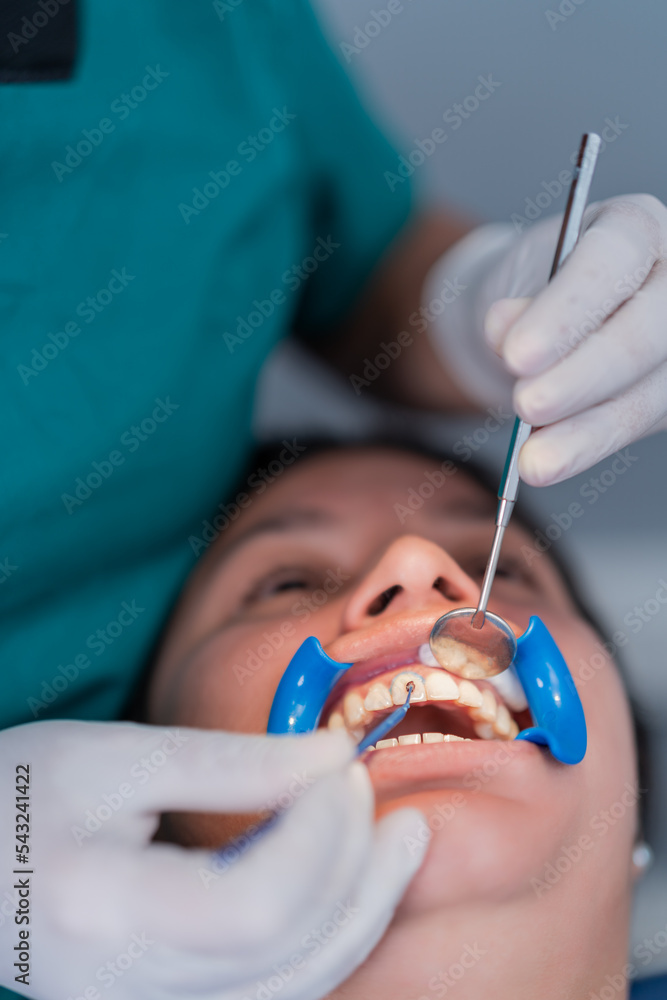 Crop dentist doing dental filling procedure on teeth of Hispanic female ...