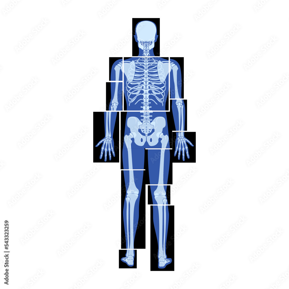 Set of X-Ray Skeleton Human body parts - hands, legs, chest, head ...