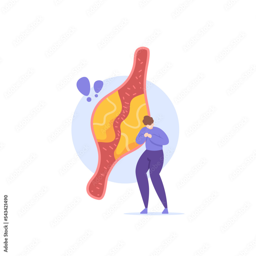 blockage of blood vessels or atherosclerosis. hardening and narrowing ...