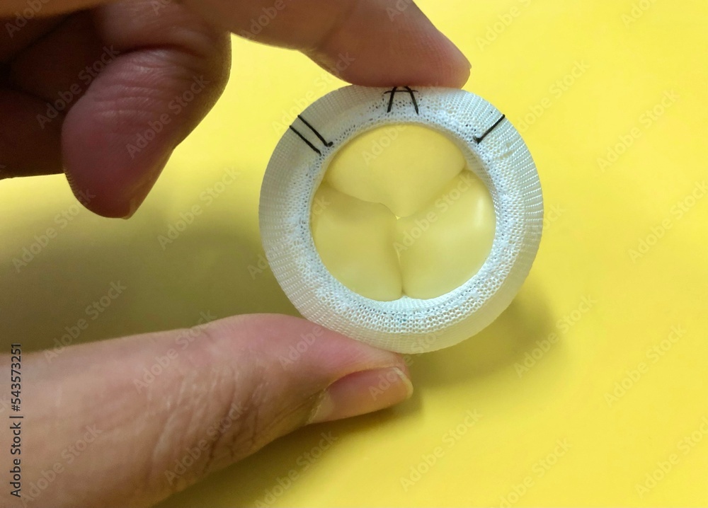 Model of bioprosthetic or tissue heart valve for valve replacement ...