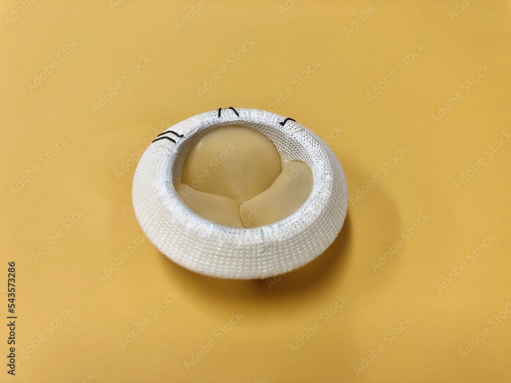 Model of bioprosthetic or tissue heart valve for valve replacement operation. Stock Photo ...