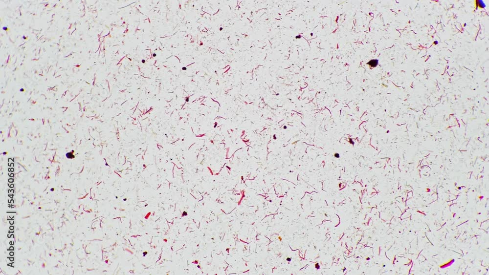 Microscopic slide with sperm smear 100x against bright field background ...