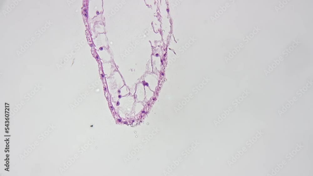 Hydra in transversal section under microscope 100x on bright field ...