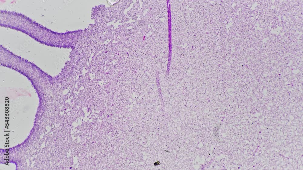 Vidéo Stock Agaricus in section magnified 100x under microscope in ...