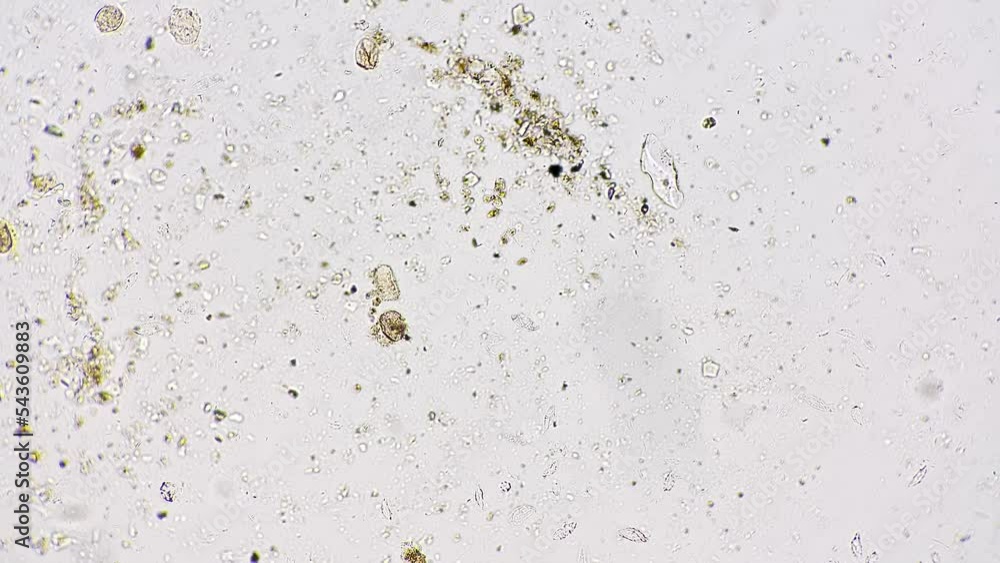 Zygote of ascarid lumbricoide whole mount filmed under microscope 100x ...