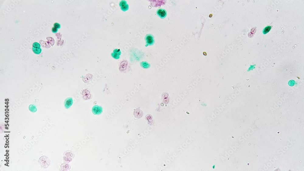 Cosmarium whole mount filmed against bright field under microscope with ...