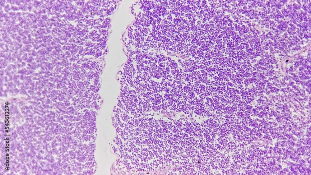 Thymus in transversal section magnified under microscope 200x and ...