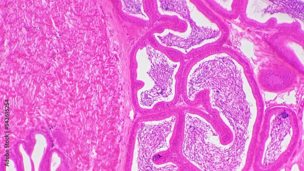 Testis shown under microscope in transversal section and magnified in ...
