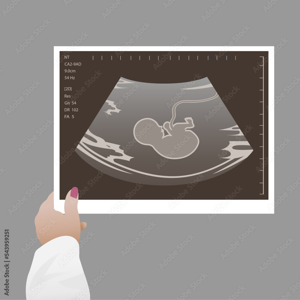 Ultrasound of a child. An ultrasound scan of the fetus of a pregnant ...