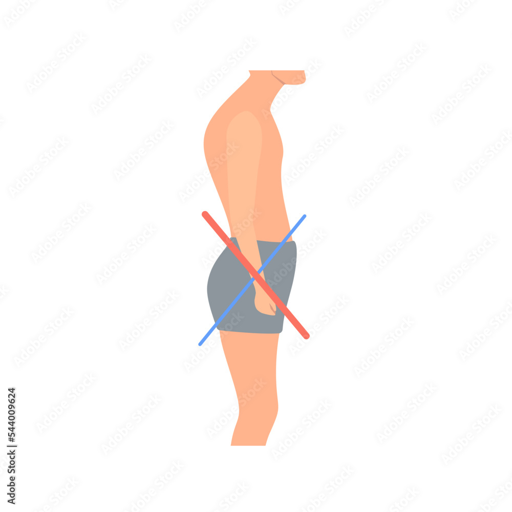 Lower crossed syndrome medical diagram. Crooked man with muscle ...