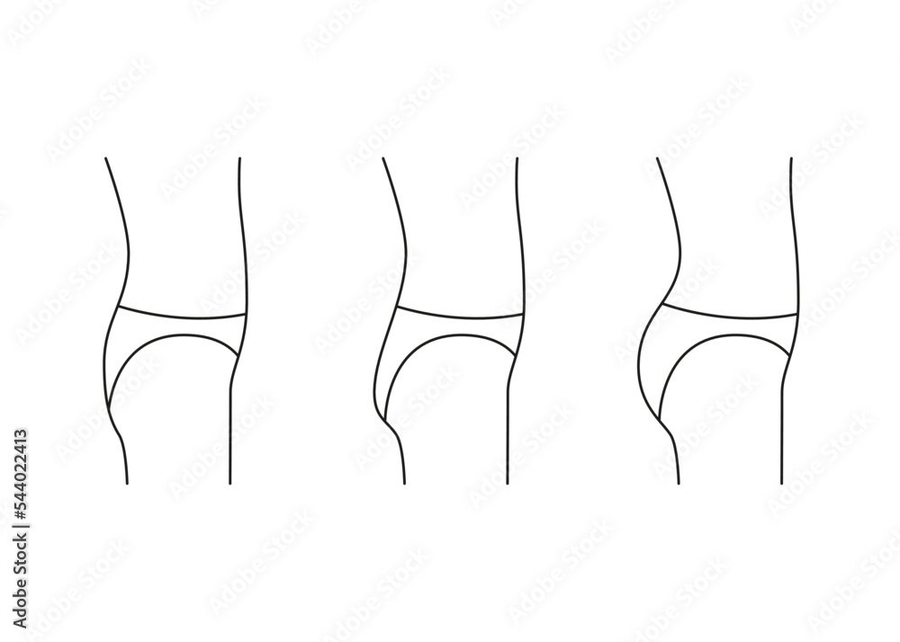 Types of butt woman, shape buttock side, line icon. Augmentation ...