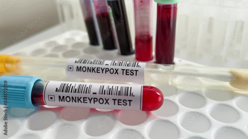 Samples and Test tubes for analysis and diagnostic of antigens and ...