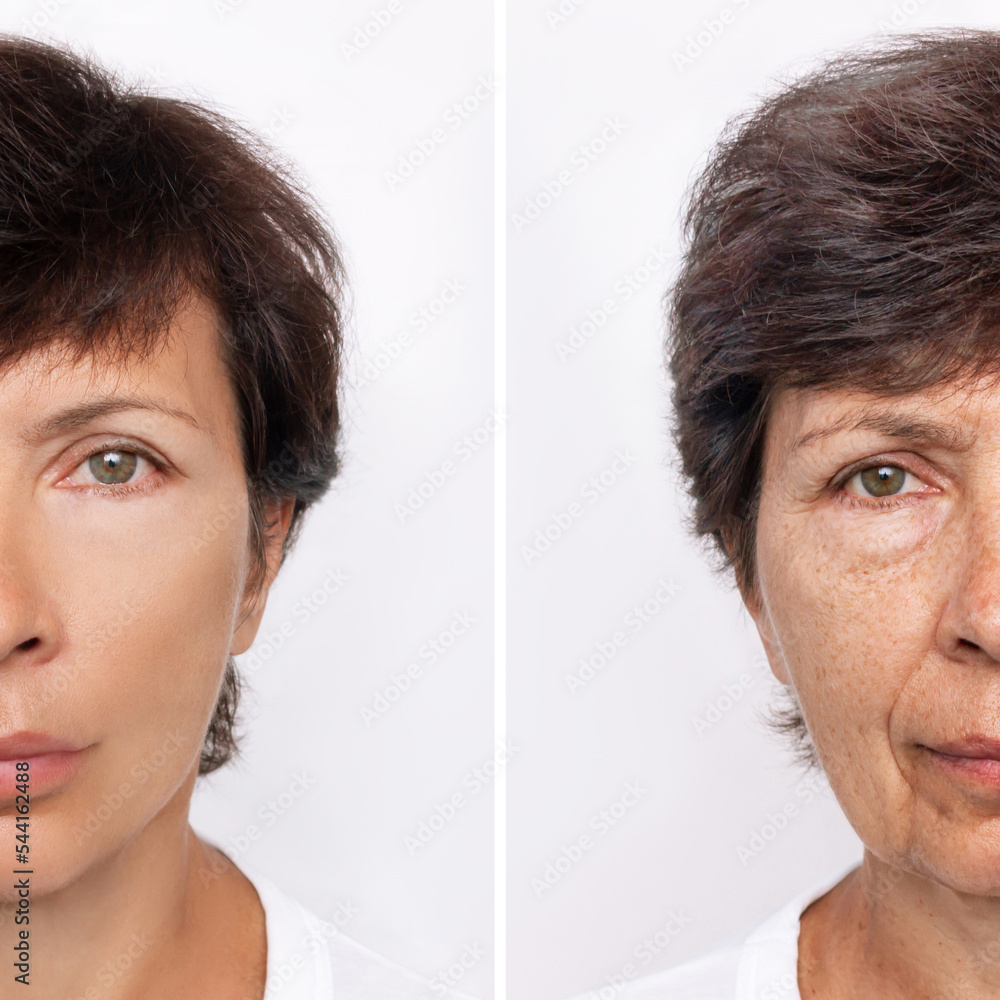 Comparison of young and aged woman's face. Youth, old age. The process ...