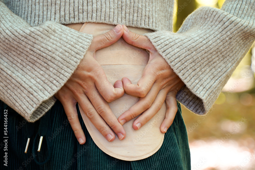 heart-shaped hands on a woman's ostomy in the forest. colostomy bag for ...