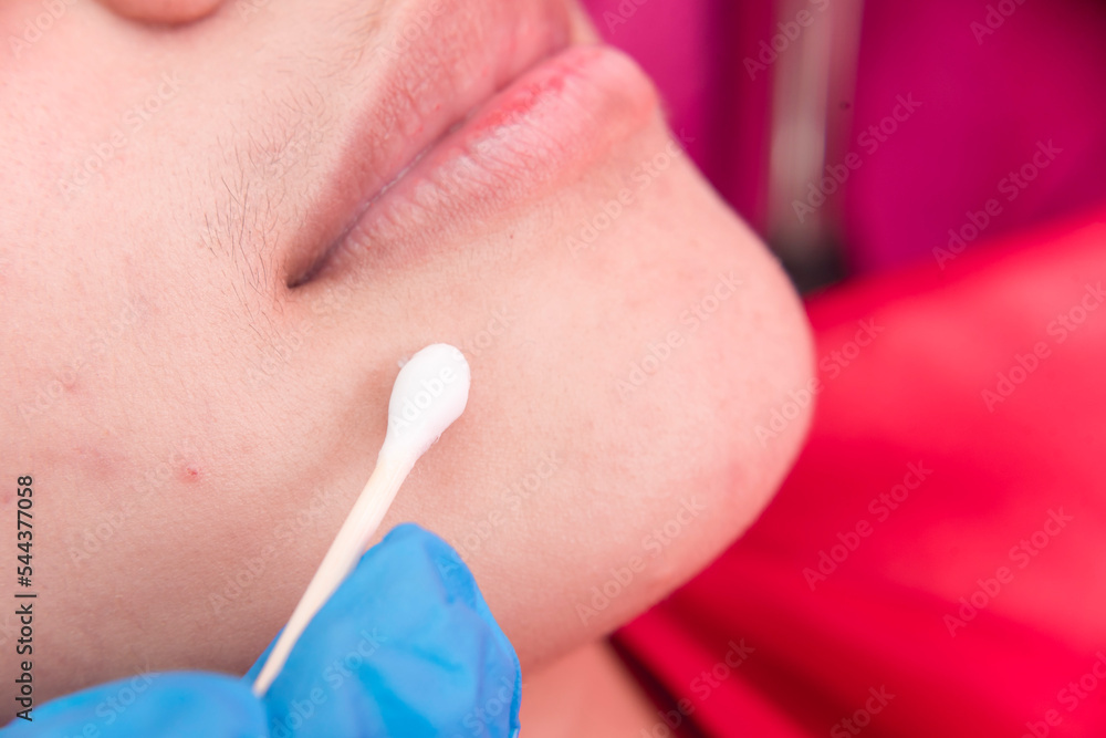 An Esthetician applying numbing cream or local anesthetic to small ...