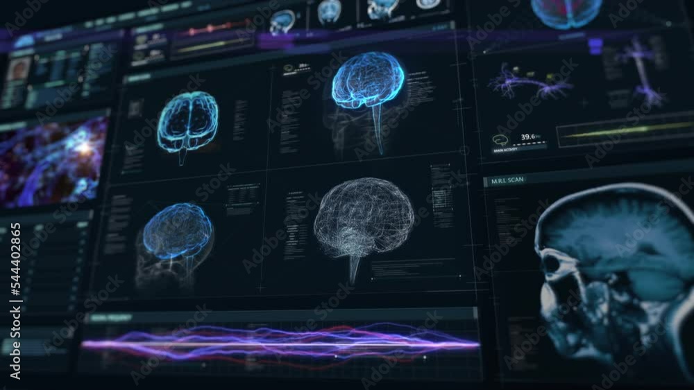 Futuristic HUD Interface Showing Brain and Neurons Of Anatomy and MRI Information. Illness ...