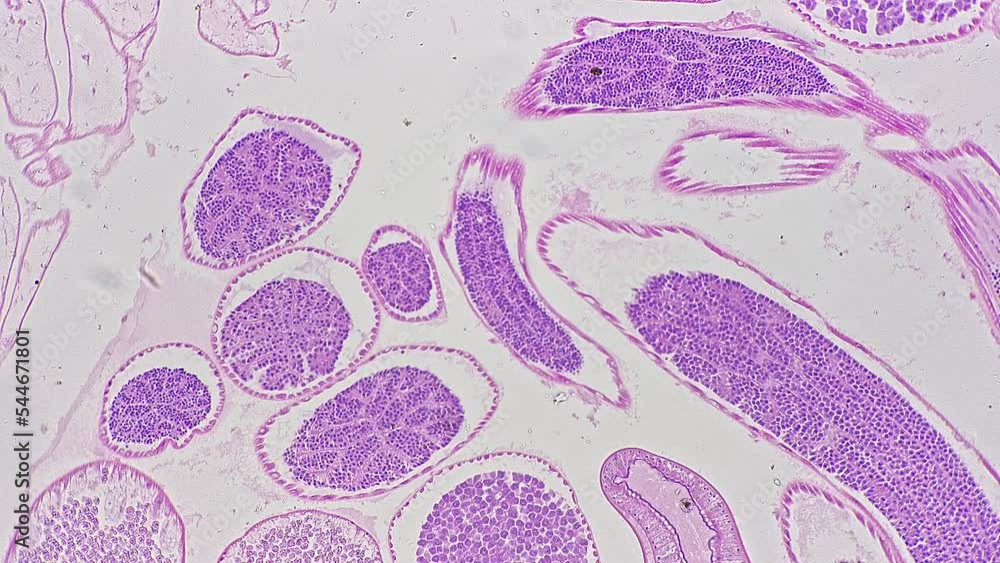 Ascaris in cross section magnified under microscope in 100 times filmed ...