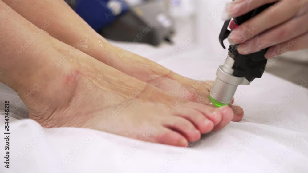 Close up video of professional cosmetologist doing laser hair removal ...