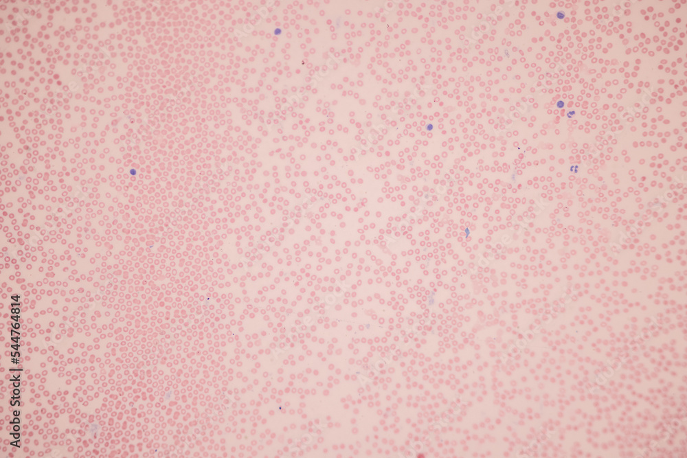 Tissue of Blood human, Vein human, Artery human and Heart muscle human ...