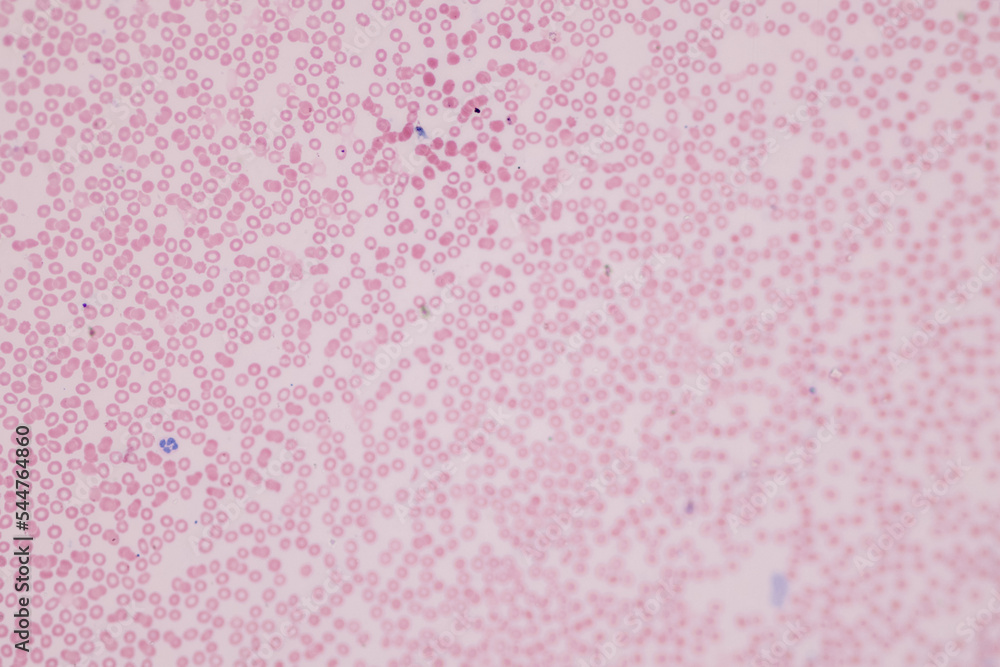 Tissue of Blood human, Vein human, Artery human and Heart muscle human ...