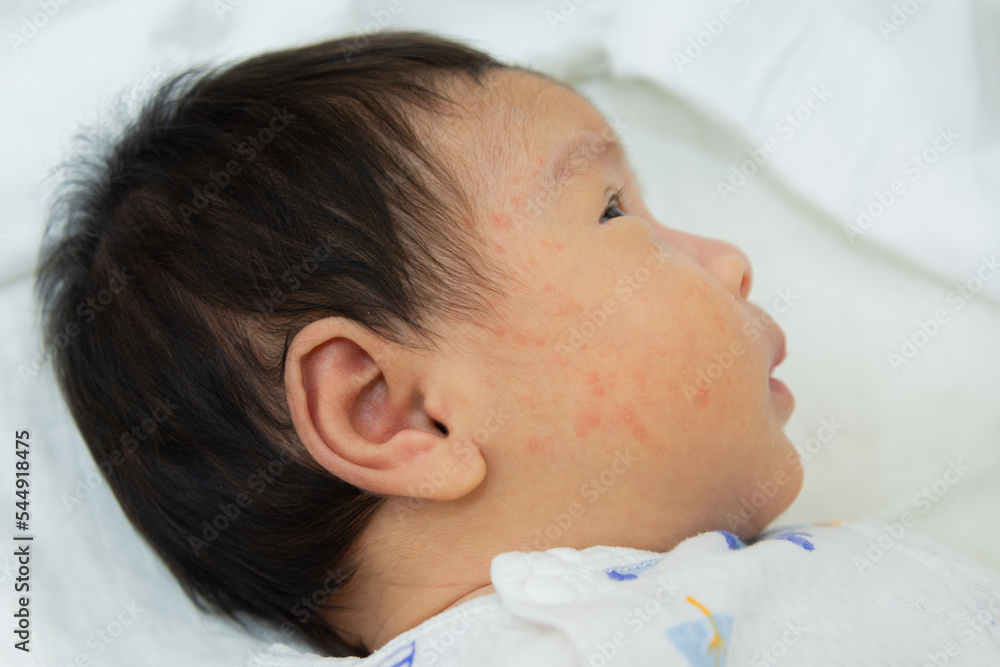 portrait of the face of a newborn baby with red cheeks with small ...