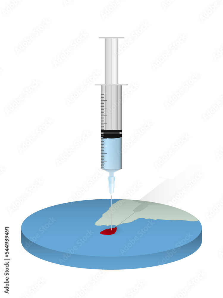 Vaccination of Sri Lanka, injection of a syringe into a map of Sri ... Vaccination of Sri Lanka, injection of a syringe into a map of Sri ...