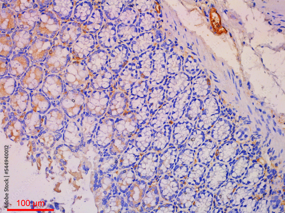 Immunohistochemistry Staining in Histopathology Stock Photo | Adobe Stock