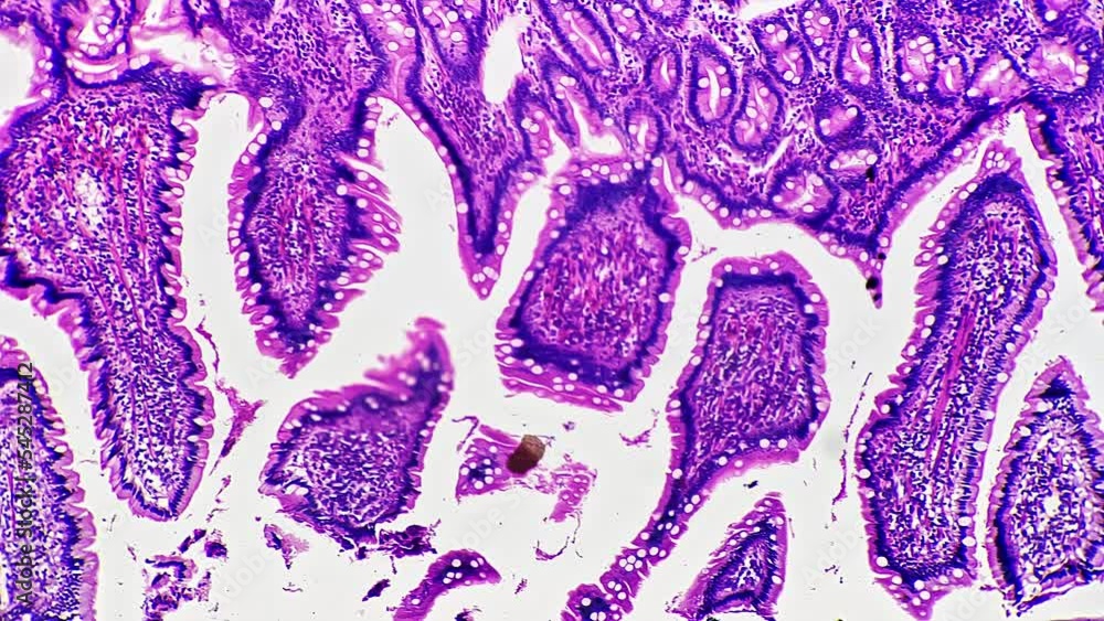 Vidéo Stock Transversal section of large intestinal under microscope ...