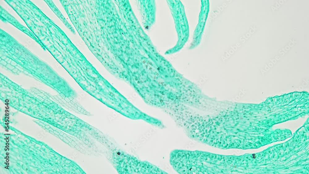 Fruit of ficus carica in transversal section magnified under microscope ...