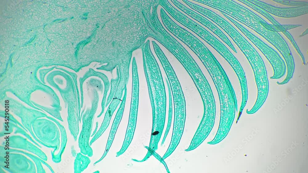 Fruit of ficus carica in transversal section magnified under microscope ...