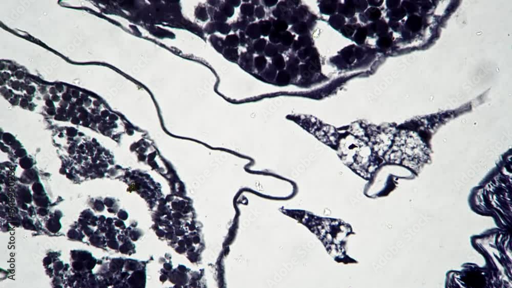 Stockvideon Meiosis of grasshopper in section under microscope 400x ...