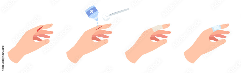 First aid treatment for wound on finger process isolated on white ...