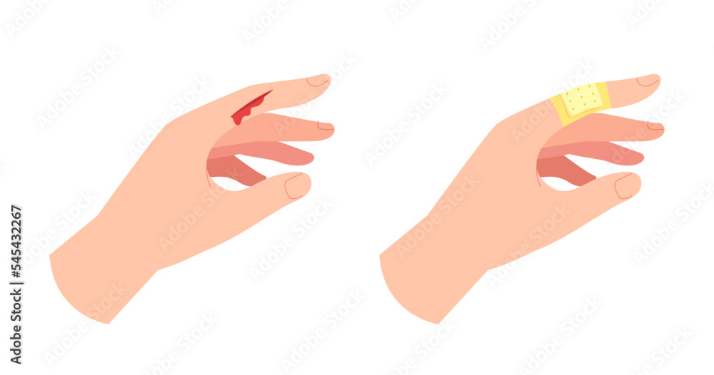 Bleeding wound on finger hand and band-aid cure hand isolated on white ...