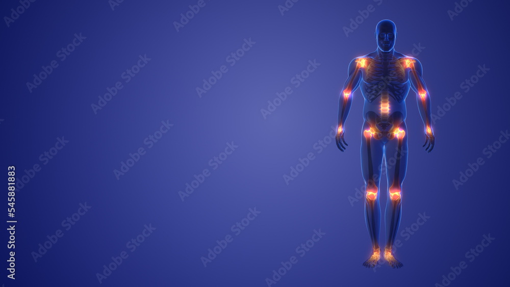 Human body joint pain medical concept Stock Illustration | Adobe Stock