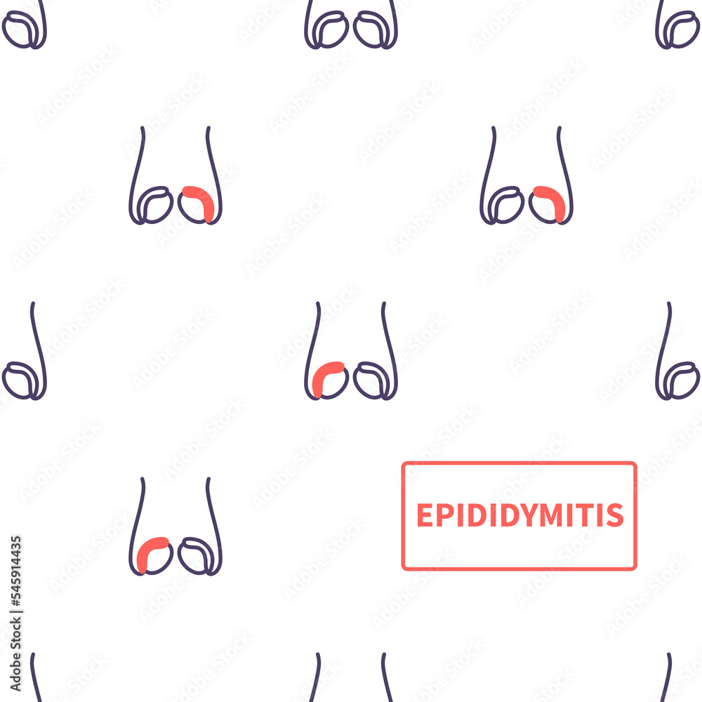 Epididymitis disease awareness. Inflammation of testis coiled tube ...