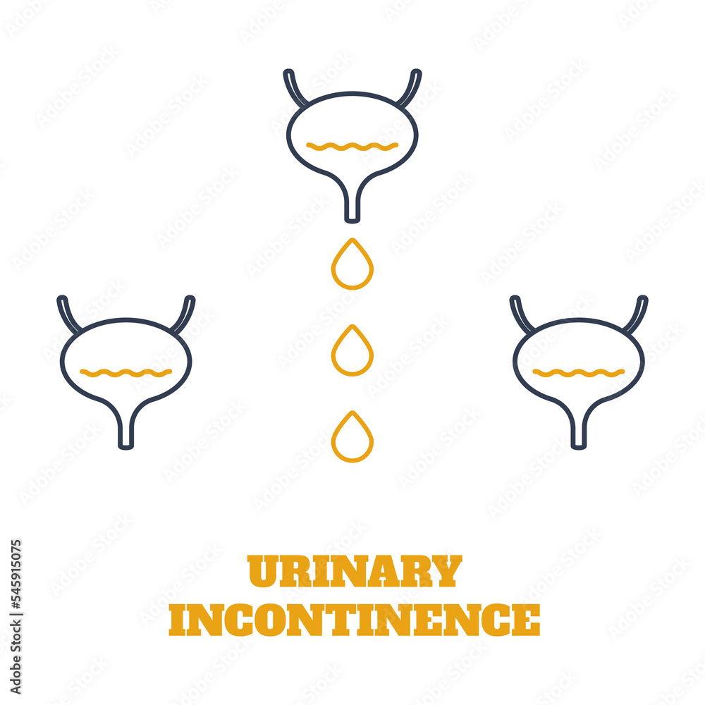 Urinary incontinence condition. Loss of bladder control. Urologic ...