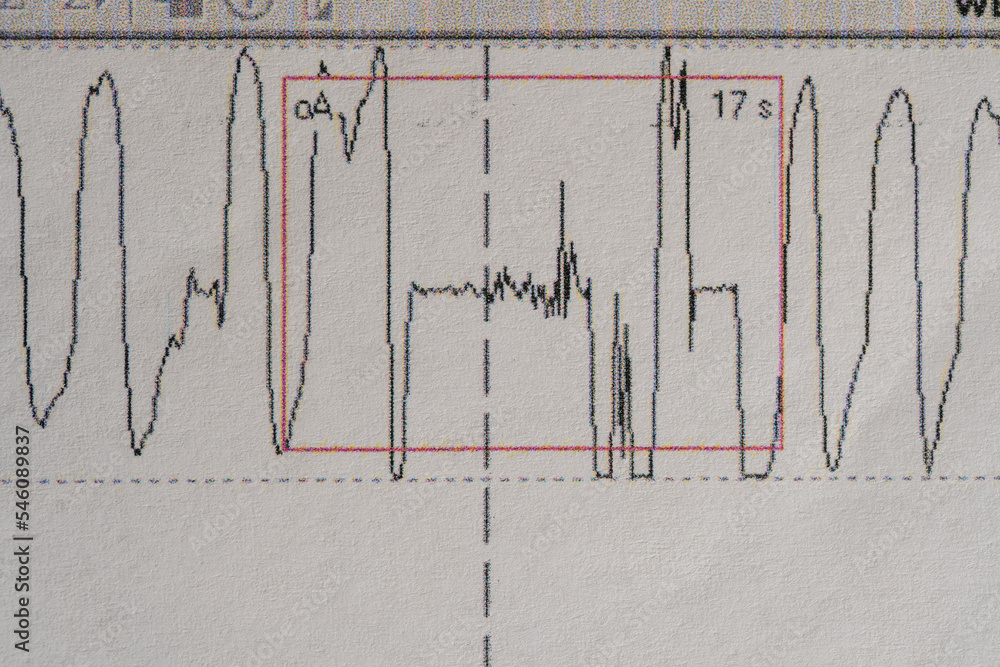 Images charts scientific cardiograms of cardiorespiratory sleep ...