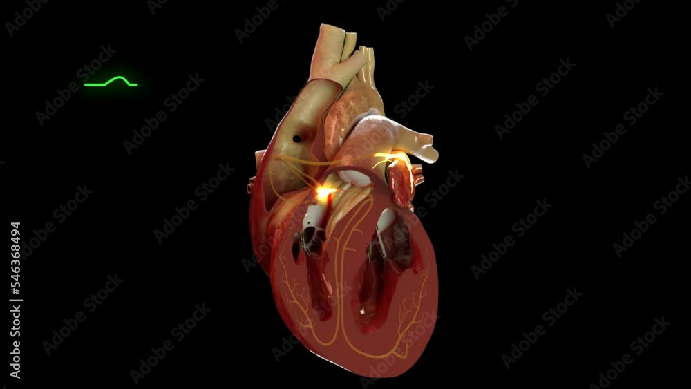Human heart showing electrical activity in sync with and EGC (EKG ...