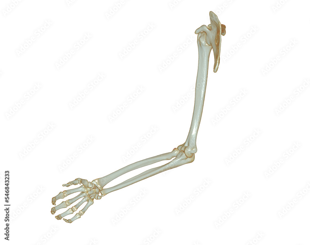 ภาพประกอบสต็อก CT SCAN of Upper extremity 3D rendering isolated on ...